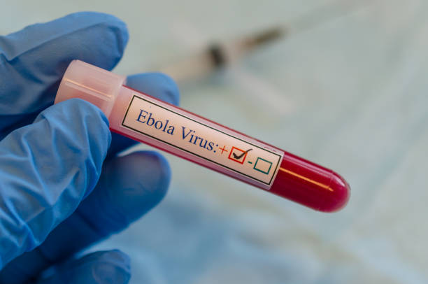 Idadi ya walioambukizwa Ebola nchini DRC yafika 1,000 - KBC Swahili